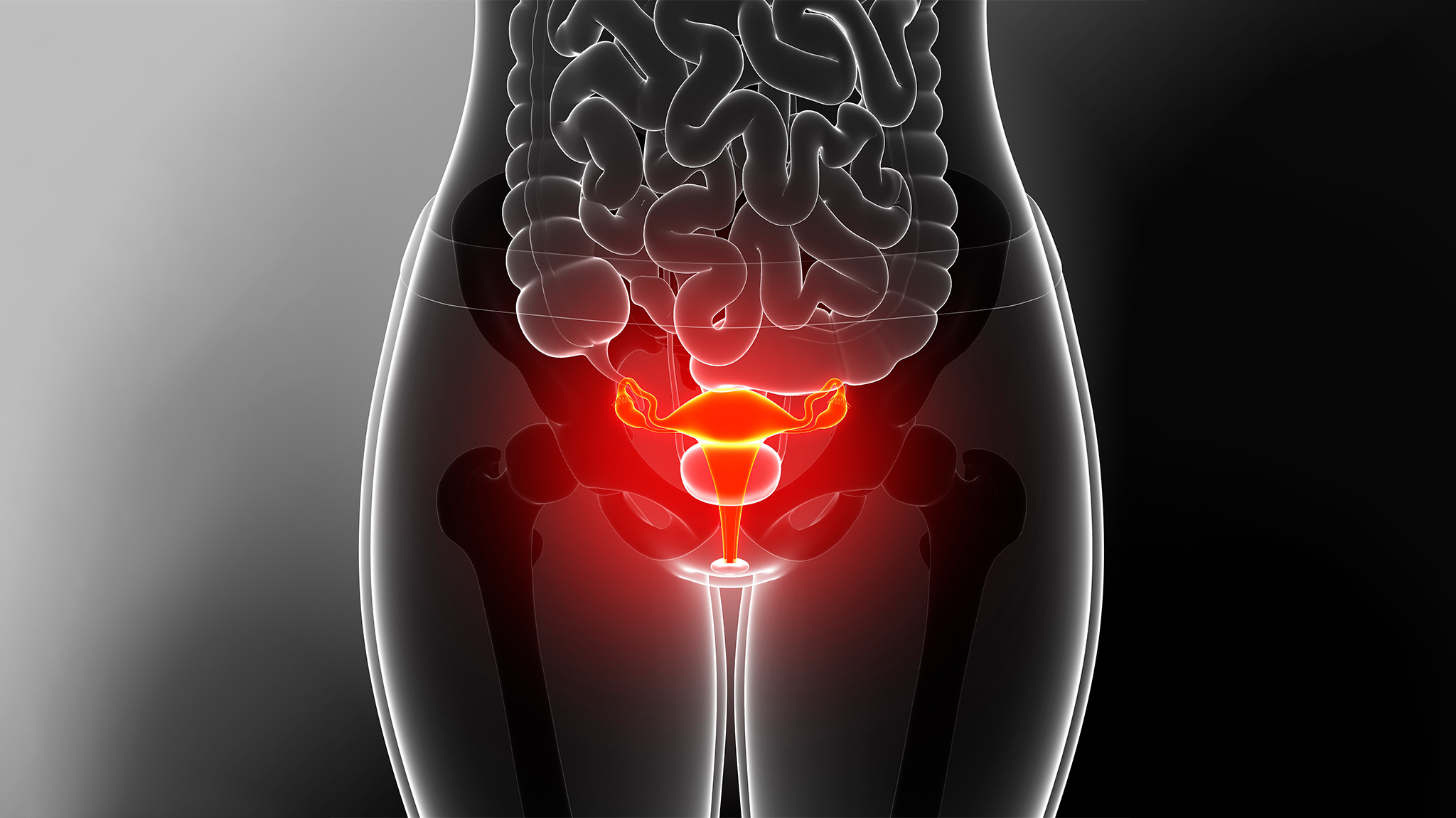 Abnormal Uterine Bleeding