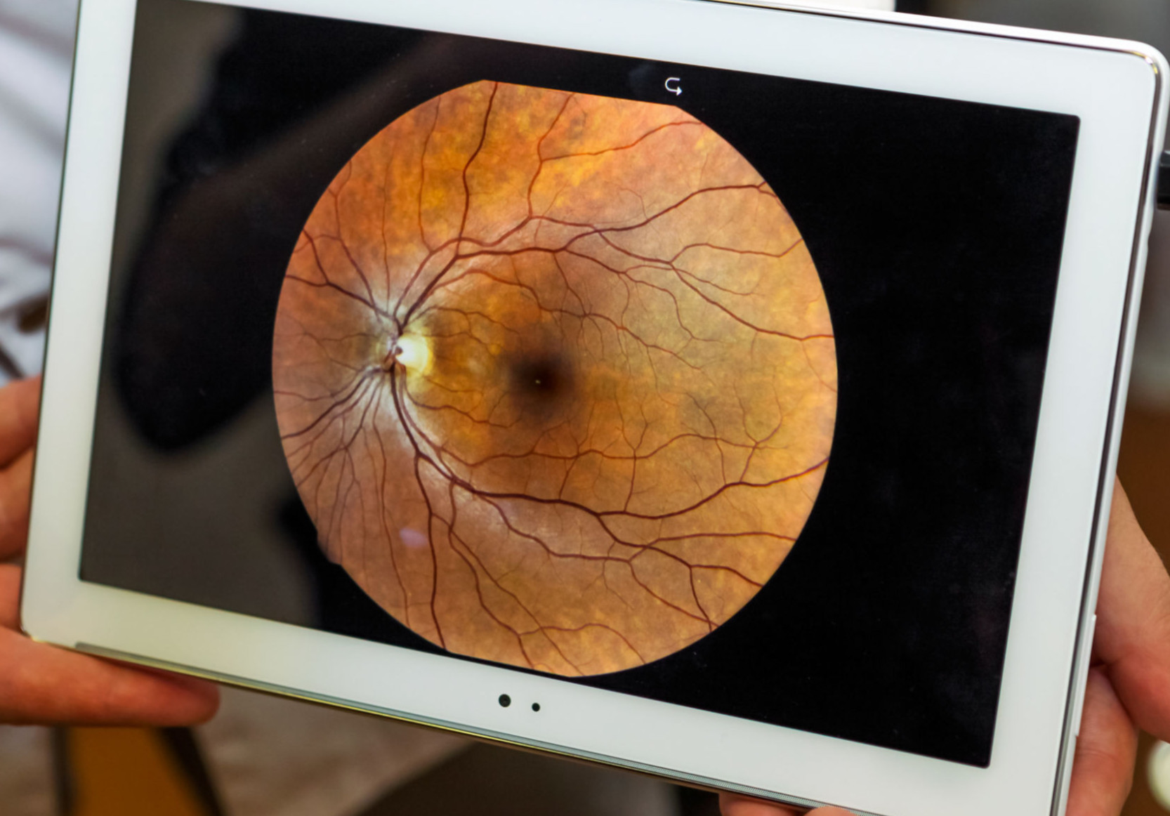 Exploring Immune Mechanisms in Ocular Diseases: New Insights into ...